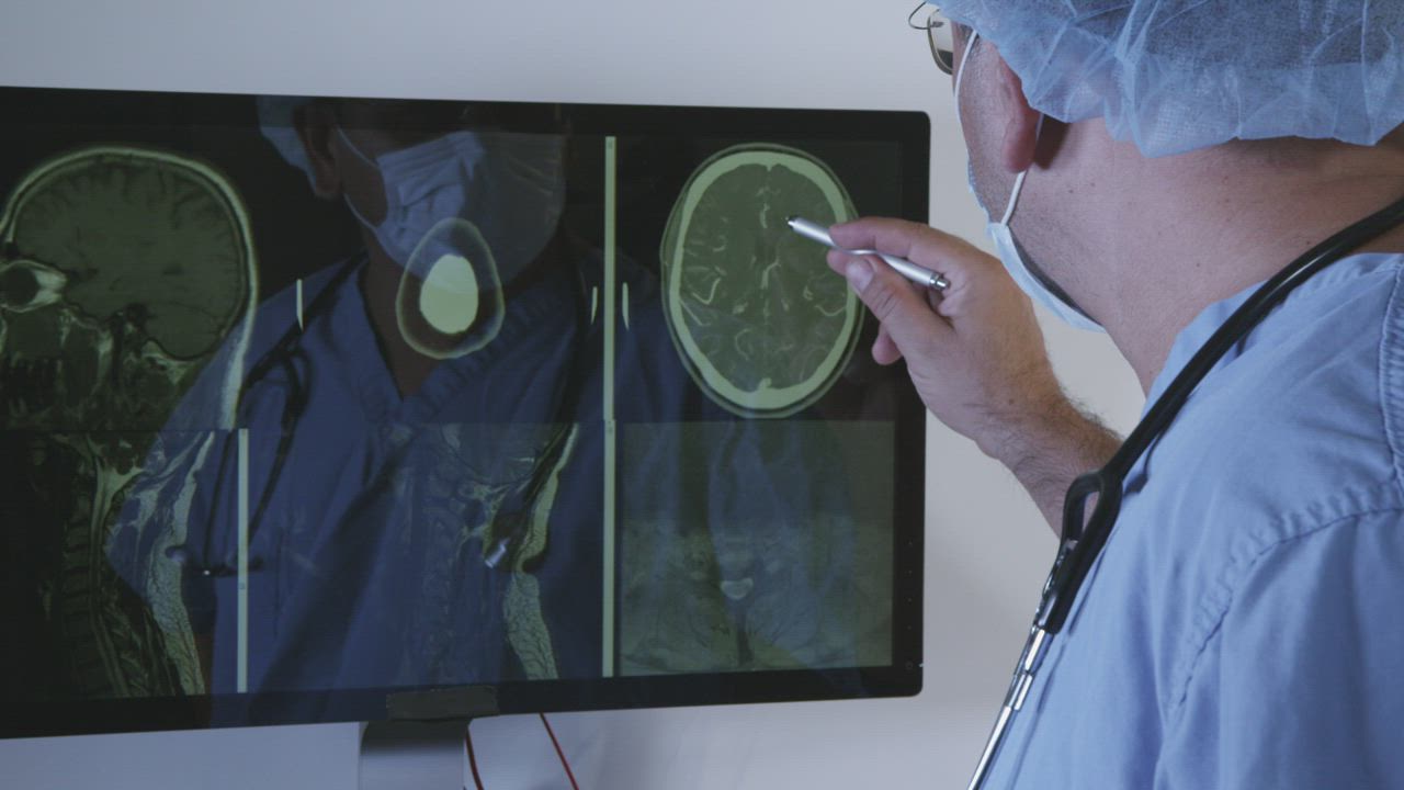 Doctor reviewing a brain scan - Free Stock Video