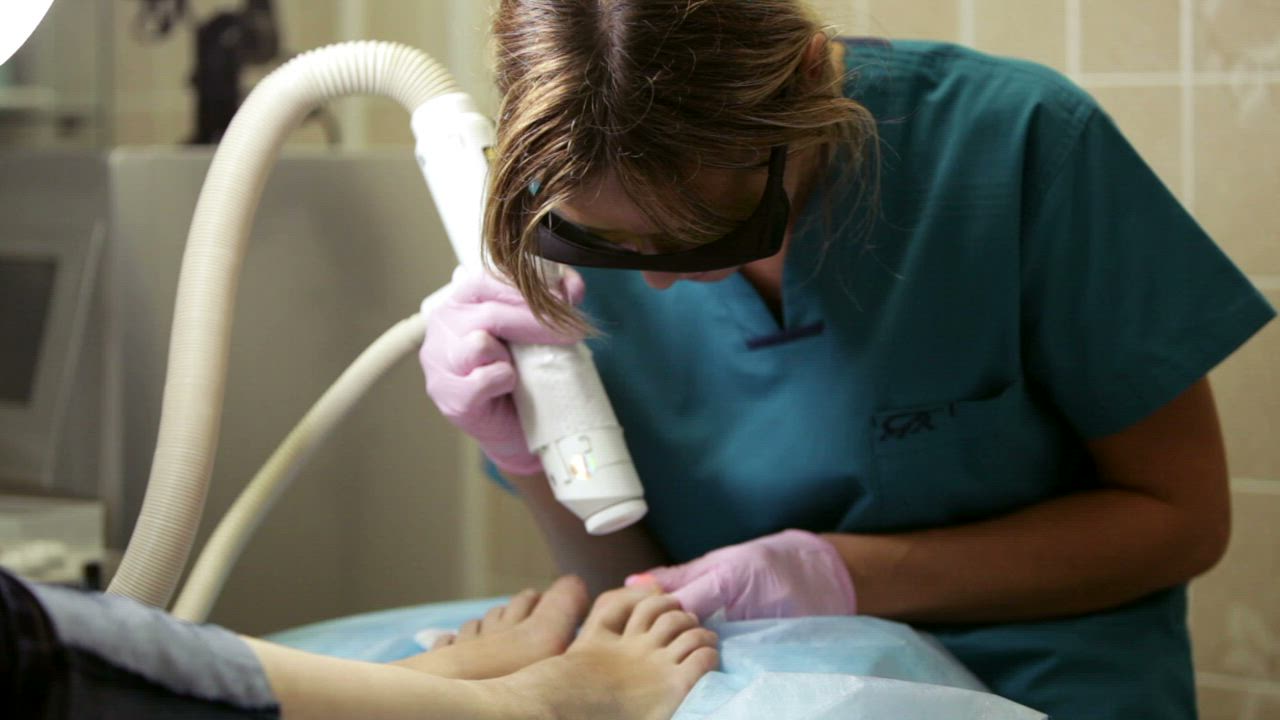 Applying laser treatment to feet - Free Stock Video