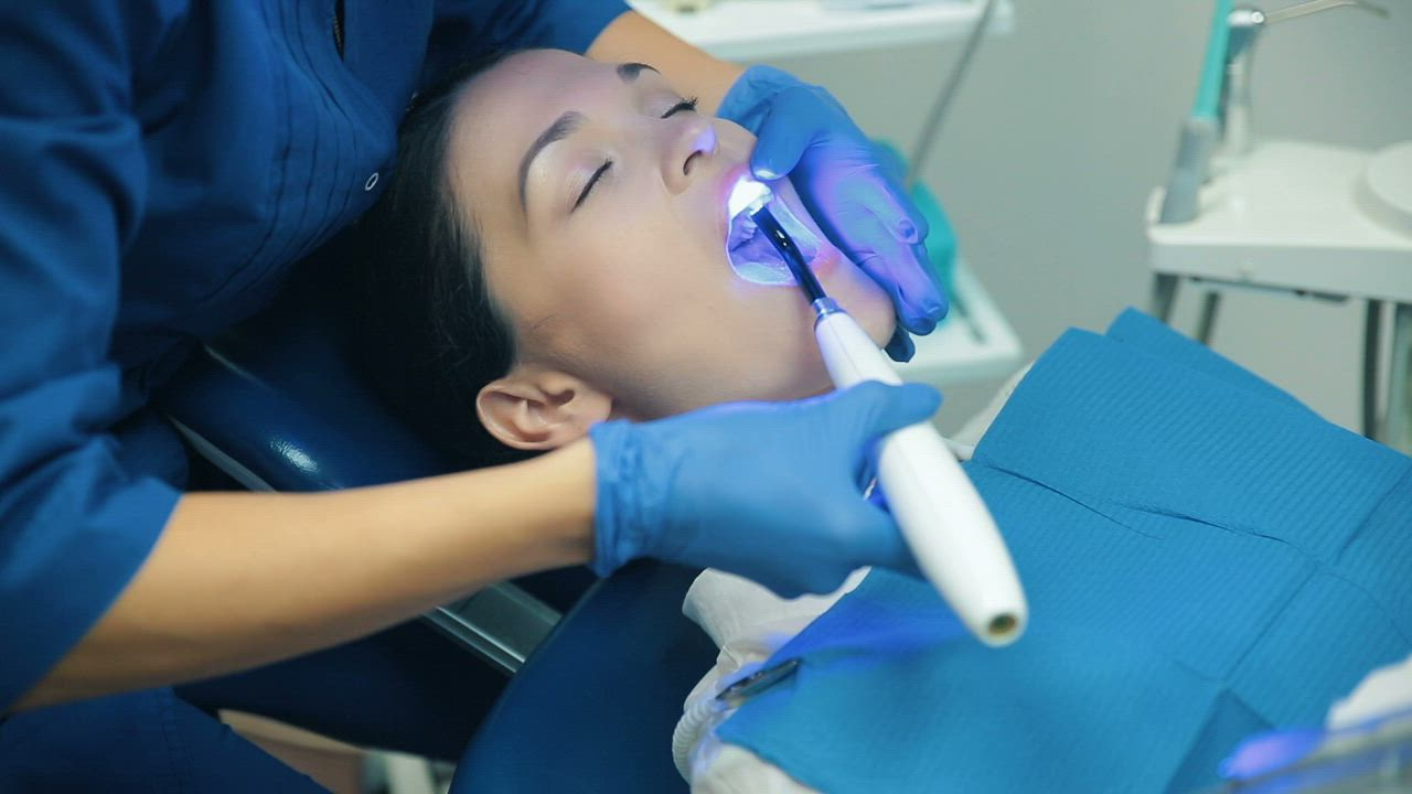 Dentist applying blue light to his patient - Free Stock Video