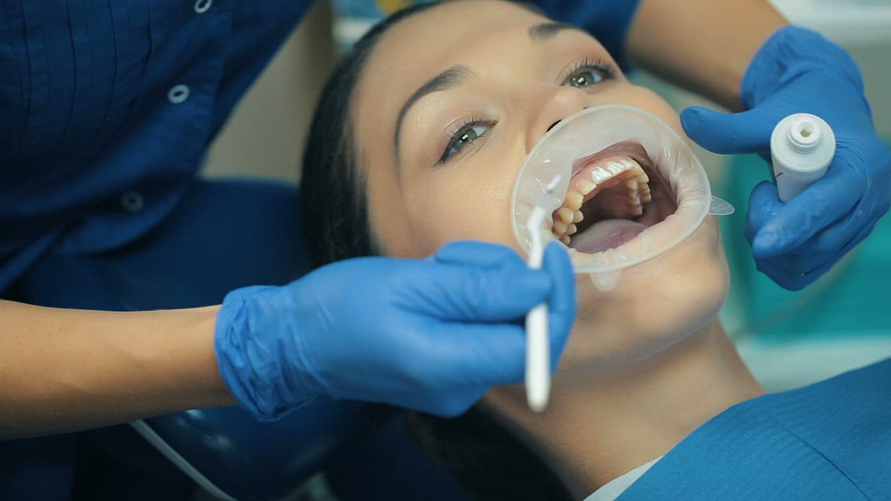 Dentist hands cleaning teeth to a patient - Free Stock Video