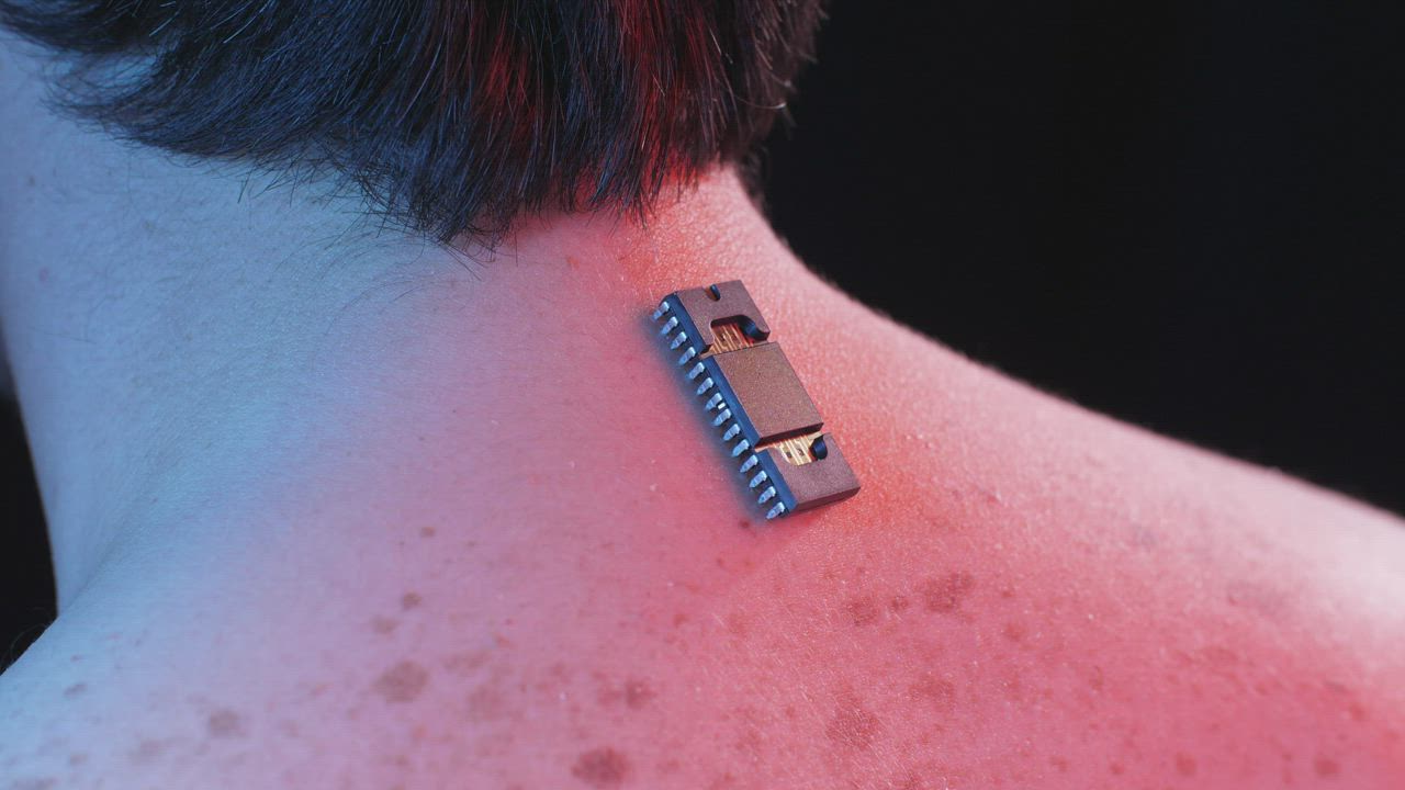 Body implant chip on the back - Free Stock Video