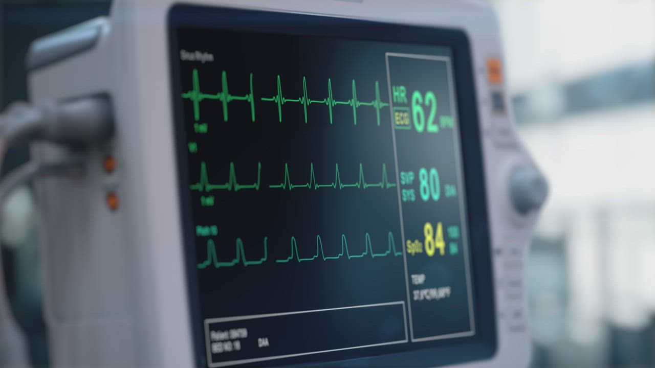 Vital signs monitor in a hospital - Free Stock Video