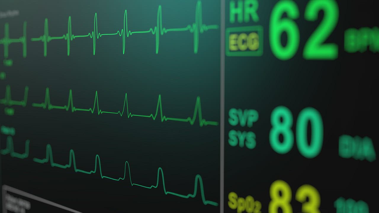 Close up of vital signs of a patient - Free Stock Video