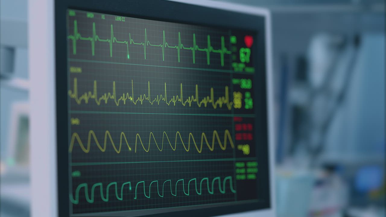 Heartbeat on a monitor - Free Stock Video